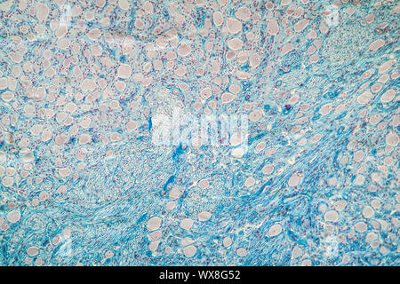 Epithelial cells of the oral mucosa under the microscope 200x Stock ...