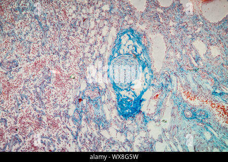 Lymph node tissue under the microscope 100x Stock Photo - Alamy