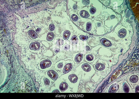 Fox tapeworm worms in infected liver 100x Stock Photo - Alamy