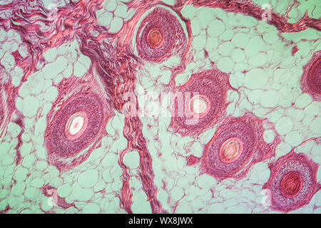 medicine microscope microscopy histology skin scalp hair crosswise ...