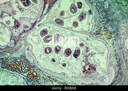 Fox tapeworm worms in infected liver 100x Stock Photo - Alamy