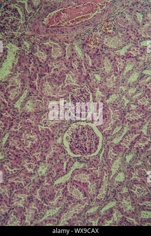 Kidney pig cross section of the kidney 100x Stock Photo - Alamy