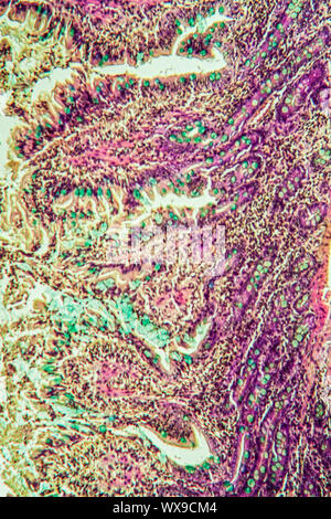 Small intestine pig across 100x Stock Photo - Alamy
