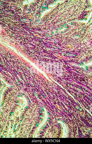 Small intestine pig across 100x Stock Photo - Alamy