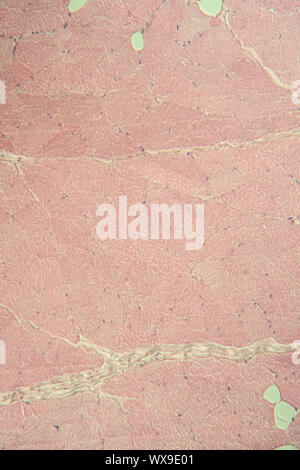 Pigskin skin under the microscope 100x Stock Photo - Alamy