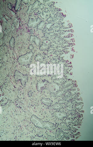 tongue cross section Stock Photo - Alamy