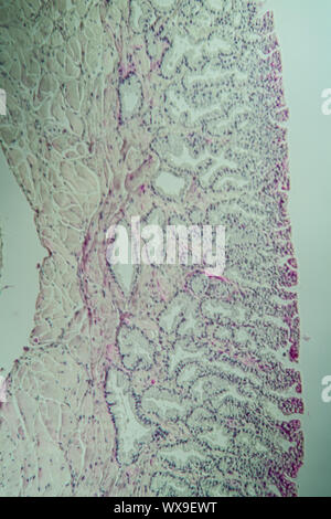 Tongue cross section with taste buds or gustatory cells. Optical ...