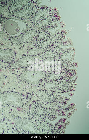 Tongue cross section with taste buds or gustatory cells. Optical ...