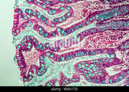 Small intestine with intestinal villi under the microscope 100x Stock ...