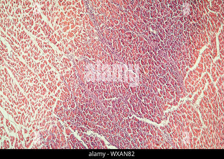 medicine microscope microscopy histology heart coronary artery vein ...