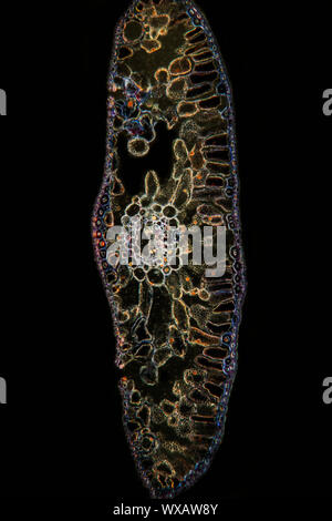 Pine needle cross-section under the microscope, background, (Pinus ...