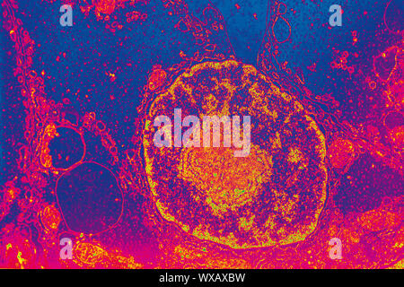 Nucleus under the electron microscope 10,000x Stock Photo - Alamy