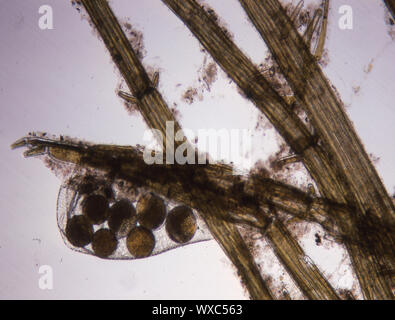 Red algae under the microscope 100x Stock Photo - Alamy