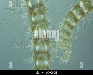 Red algae under the microscope 100x Stock Photo - Alamy