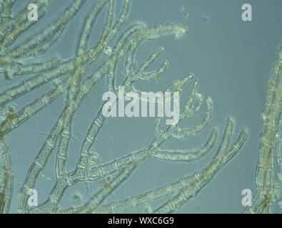 Red algae under the microscope 100x Stock Photo - Alamy