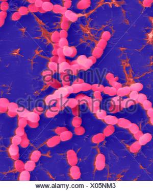 Scanning Electron Micrograph (SEM) of Streptococcus pneumoniae bacteria ...