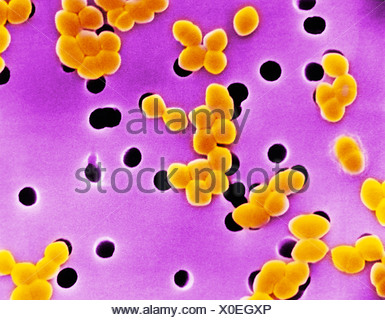 SEM of Gram-positive Enterococcus bacteria Stock Photo - Alamy