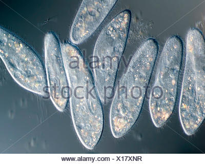 paramecium under the microscope Stock Photo: 141308650 - Alamy