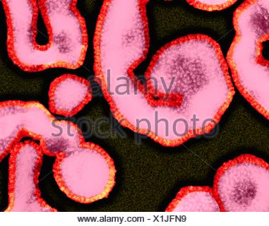 Influenza virus (RNA virus,Orthomyxoviridae Family),coloured Stock ...