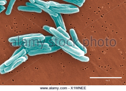 Scanning electron micrograph of Mycobacterium tuberculosis bacteria ...