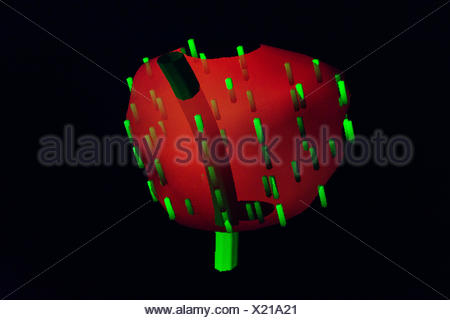 Prostate cancer radiotherapy surgery. Radiologist inserting a hollow ...