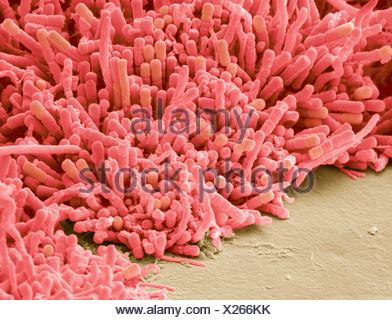 Dental plaque, coloured scanning electronmicrograph (SEM). Plaque Stock ...