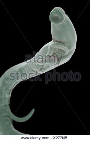 Schistosomiasis also known as snail fever is parasitic disease caused ...