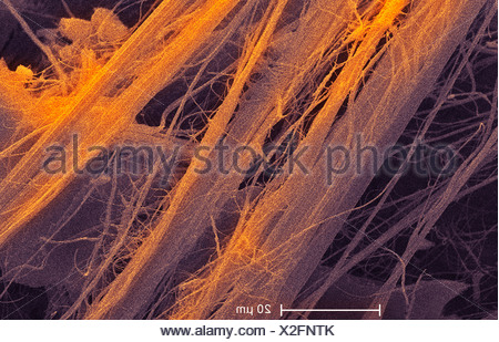 Coloured scanning electron micrograph (SEM) of Dust mite Stock Photo ...