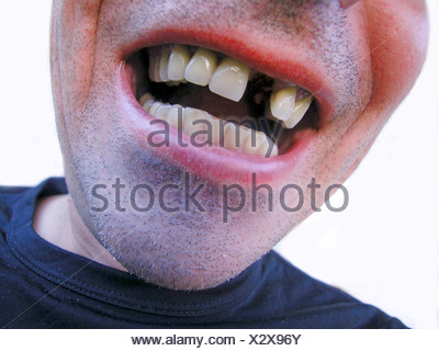 Man with a tooth gap Stock Photo - Alamy