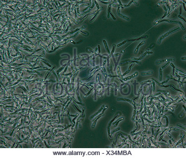 Photomicrograph of Bacillus anthracis (anthrax) spores Stock Photo - Alamy