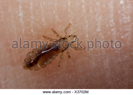 Human head louse, Pediculus humanus capitis, photomicrograph Stock ...