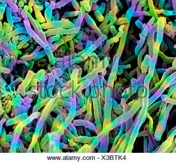 Streptomyces coelicoflavus bacteria. Coloured scanning electron Stock ...