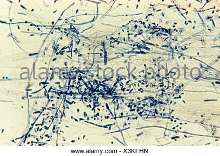 Trichophyton violaceum Fungal Organisms Stock Photo - Alamy