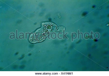 Amoeba (Amoeba sp) magnified image Stock Photo - Alamy