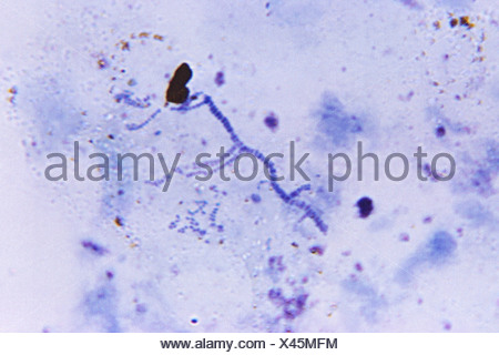Dermatophilus congolensis Bacteria Stock Photo - Alamy