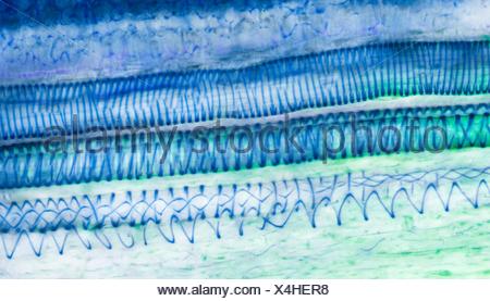 Xylem tissue. Light micrograph (LM) of a section through Stock Photo ...