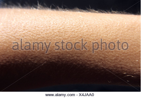 Close-up shot, goosebumps Stock Photo: 16702804 - Alamy