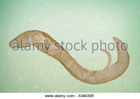 Schistosomiasis also known as snail fever is parasitic disease caused ...