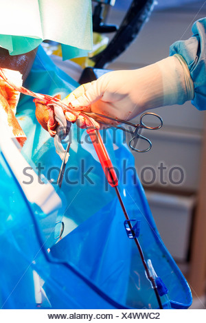 Harvesting umbilical cord stem cells. Midwife collecting blood from ...