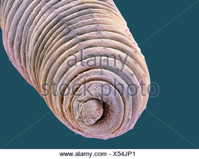 Earthworm, Lumbricus terrestris, coloured scanning electron Stock Photo ...