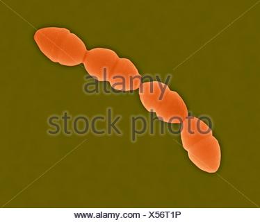 Electron micrograph of Streptococcus pneumoniae Stock Photo - Alamy