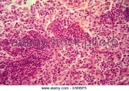 Lymph node under the microscope Stock Photo - Alamy