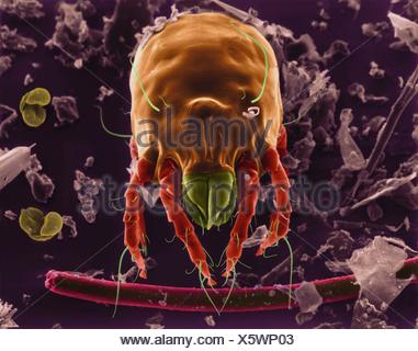 Dust mites, Coloured scanning electron micrograph (SEM) of a number ...