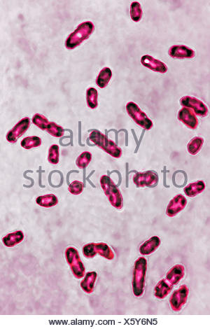 Yersinia pestis, Gram-negative bacillus, 1000x Magnification. Y Stock ...