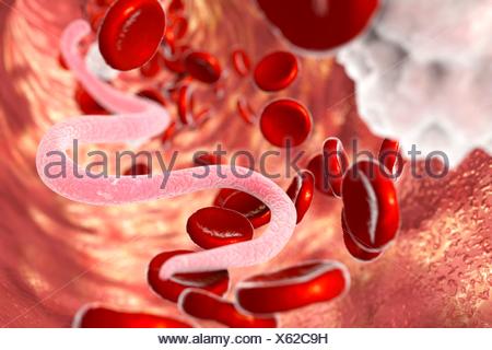 Microfilaria worms in blood. Computer illustration showing immature ...