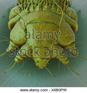 A close up view of the cause of scabies - the mite Sarcoptes scabiei ...