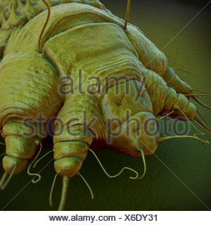 A close up view of the cause of scabies - the mite Sarcoptes scabiei ...