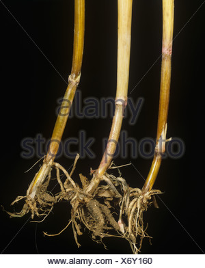 Foot Fungus disease with a close up of the human body showing toes ...