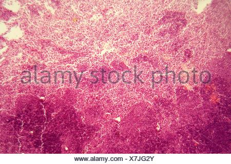 Lymph node under the microscope Stock Photo - Alamy