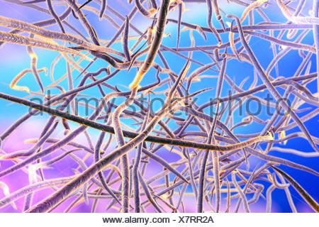 Nocardia bacteria, computer illustration. Gram-positive bacteria, one ...